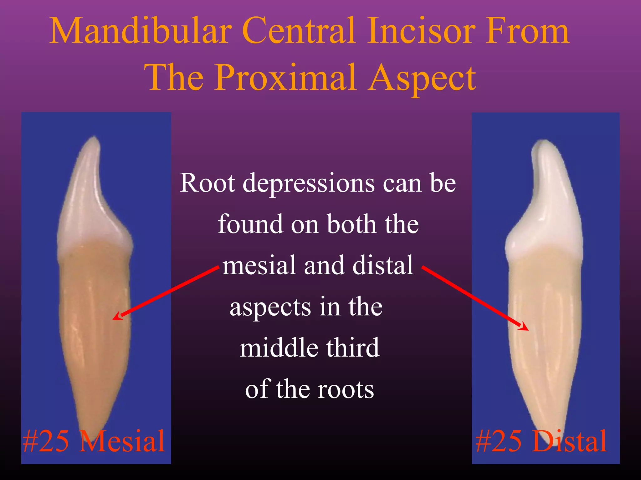 Maxillary Lateral and Mandibular Incisors | PPT