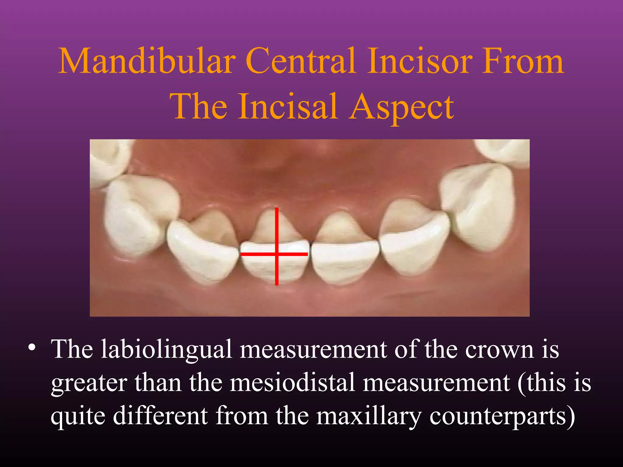 Maxillary Lateral and Mandibular Incisors | PPT