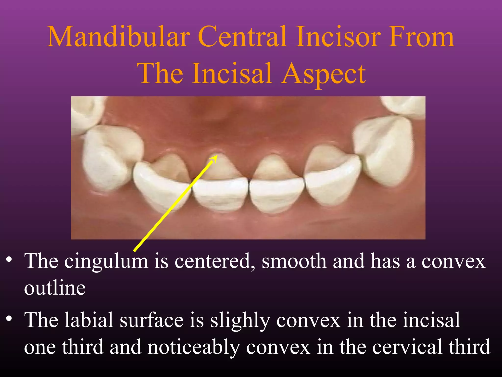 Maxillary Lateral and Mandibular Incisors | PPT