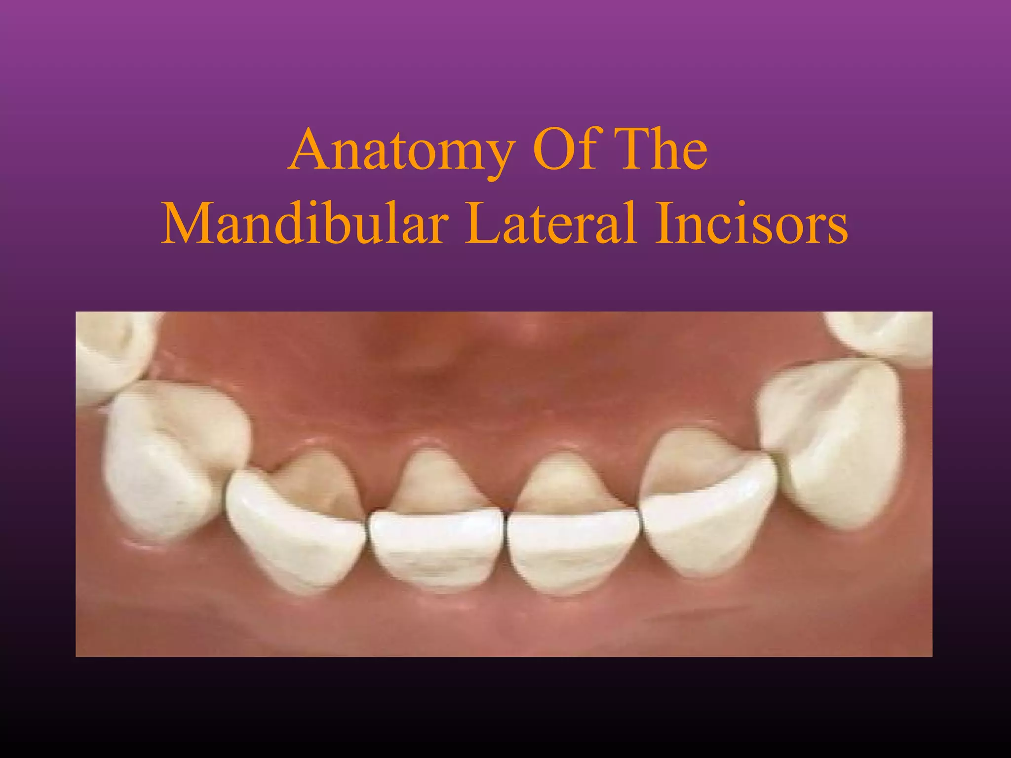 Maxillary Lateral and Mandibular Incisors | PPT
