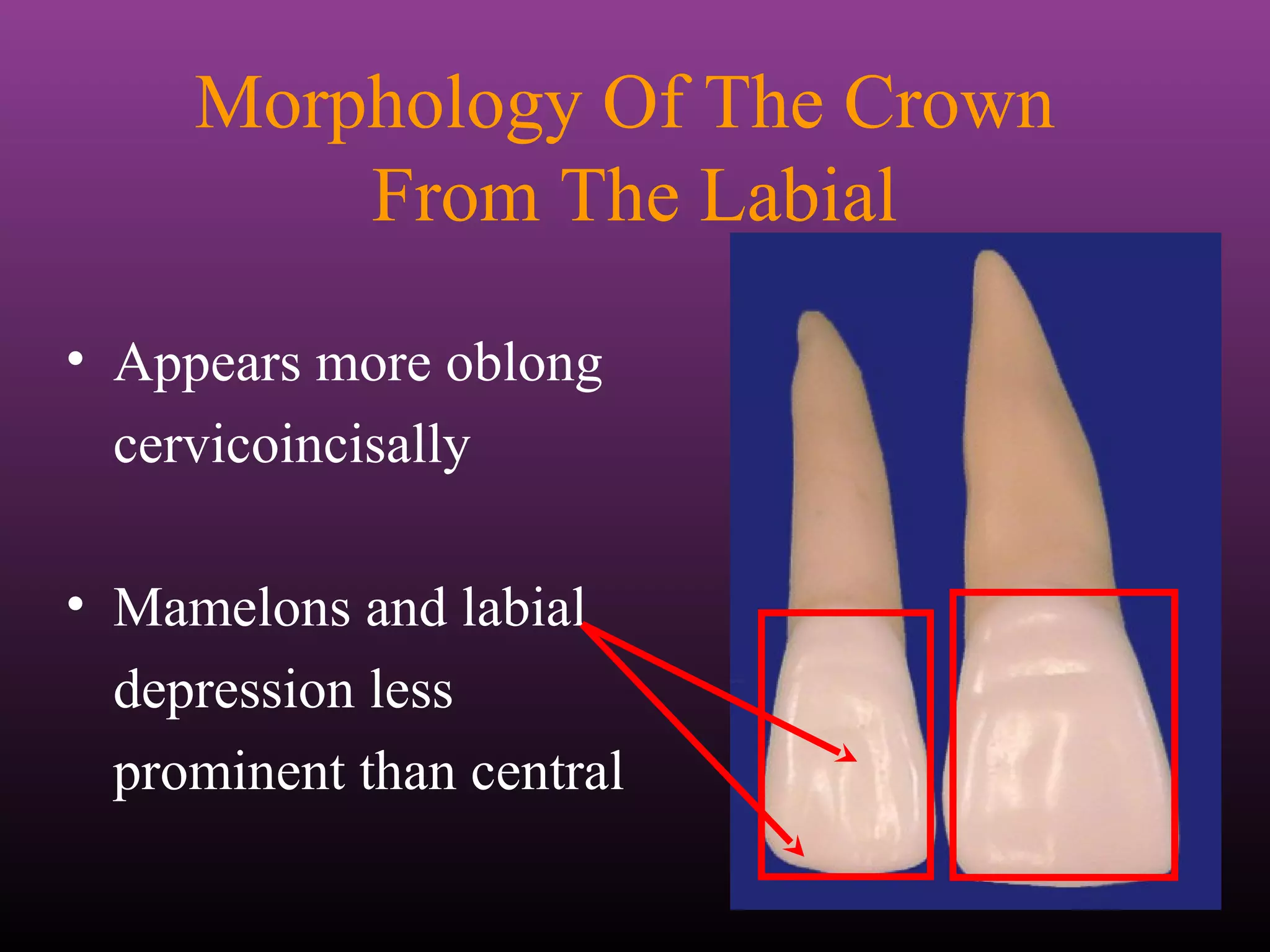 Maxillary Lateral and Mandibular Incisors | PPT