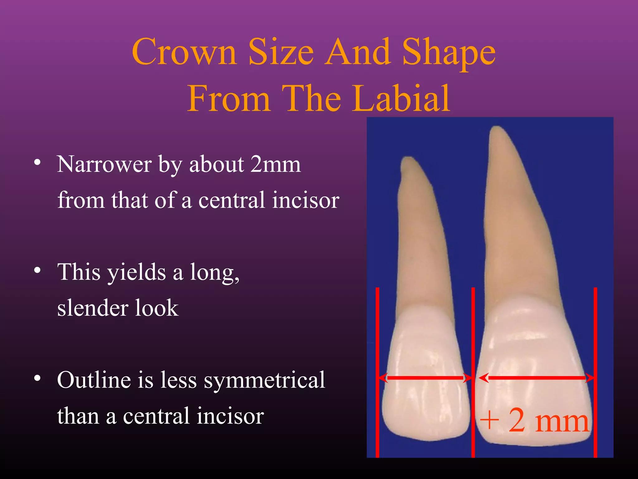 Maxillary Lateral and Mandibular Incisors | PPT