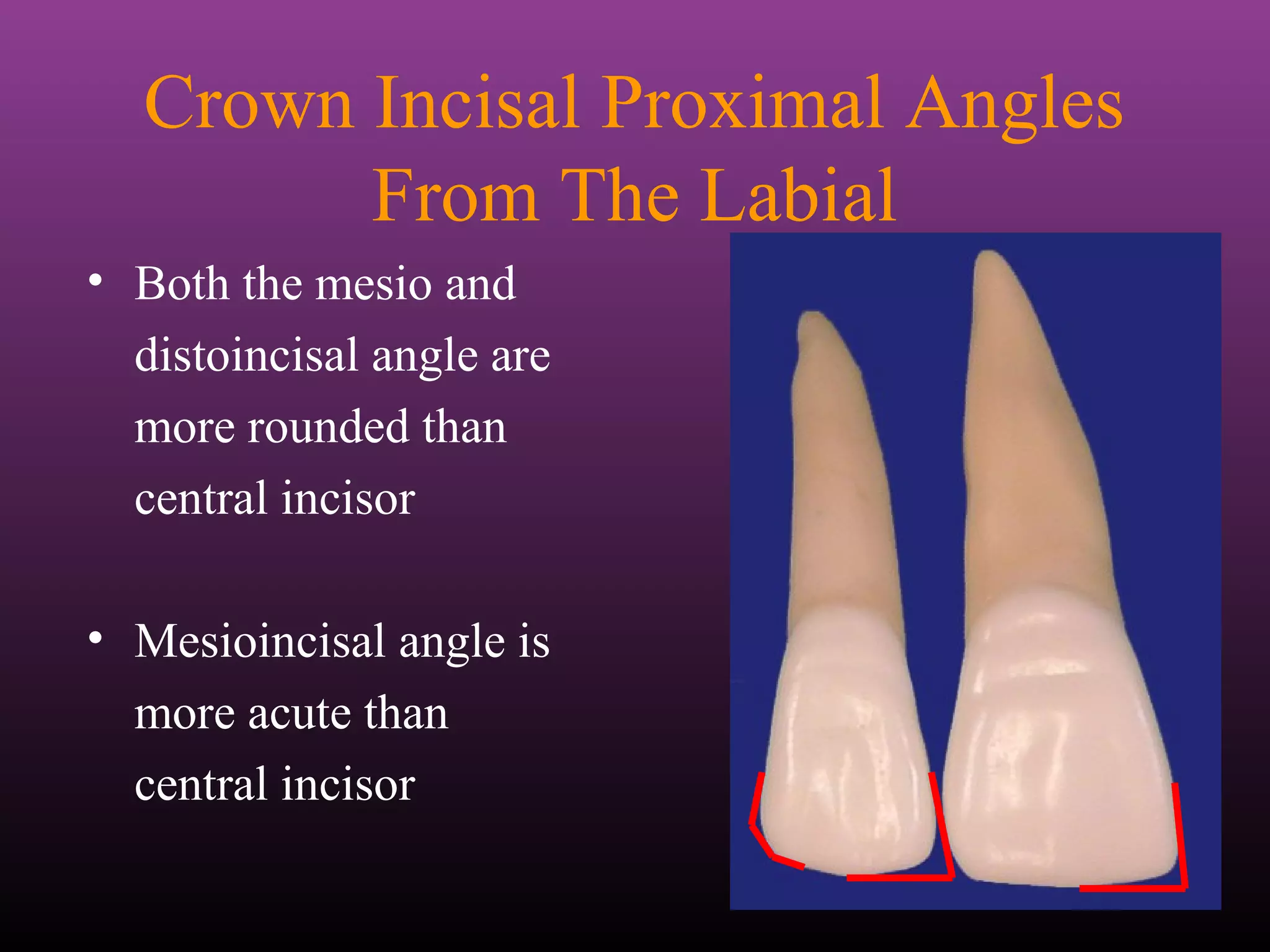 Maxillary Lateral and Mandibular Incisors | PPT