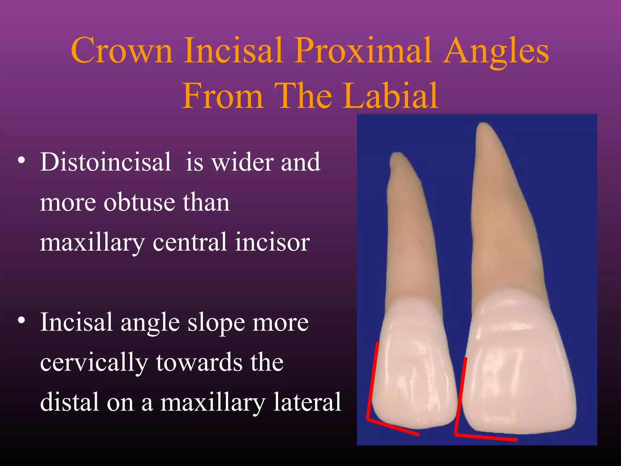 Maxillary Lateral and Mandibular Incisors | PPT
