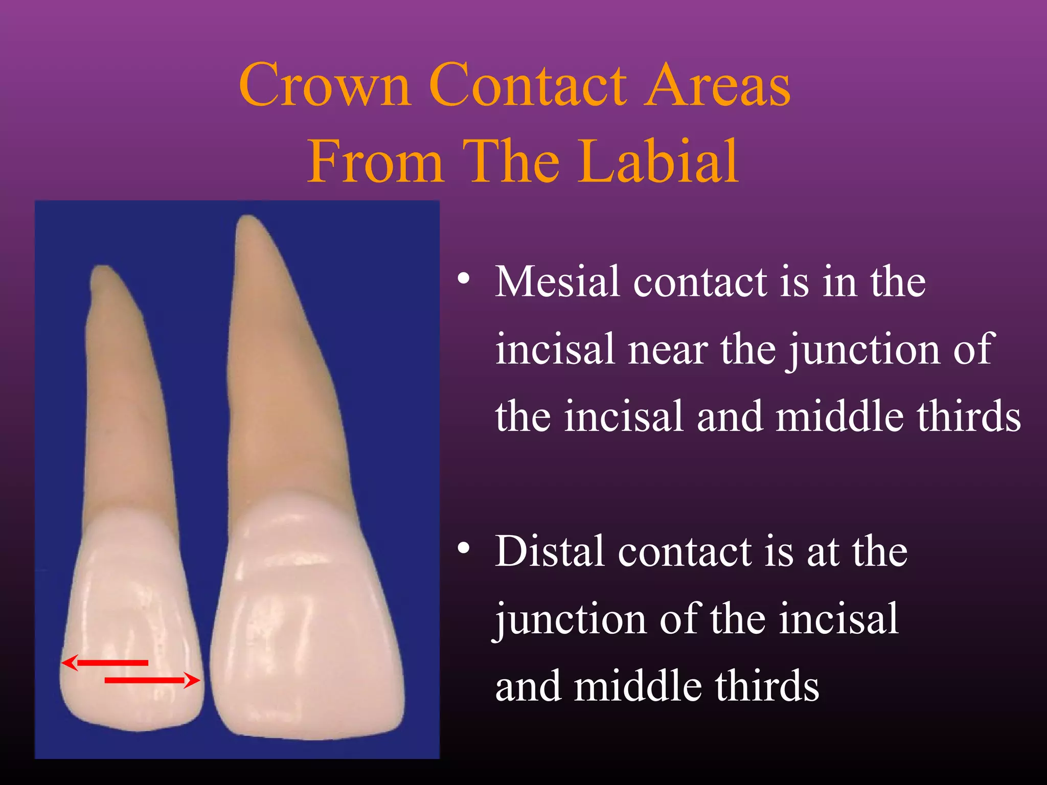 Maxillary Lateral and Mandibular Incisors | PPT