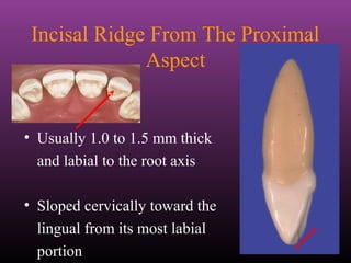 Maxillary Lateral and Mandibular Incisors | PPT