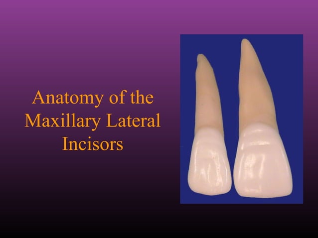 Maxillary Lateral and Mandibular Incisors | PPT | Dental Health ...