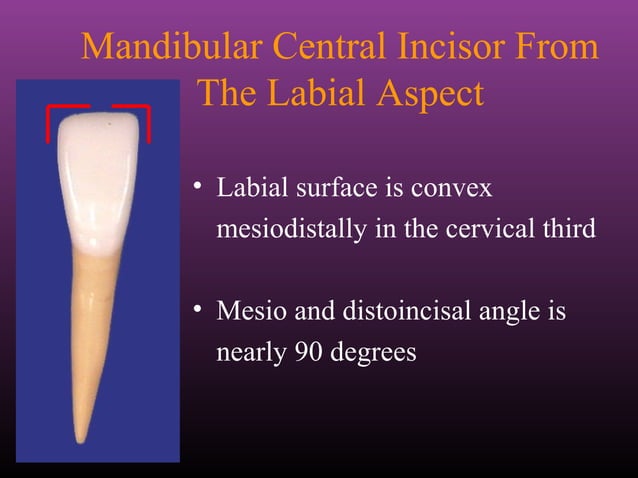 Maxillary Lateral and Mandibular Incisors | PPT | Dental Health ...