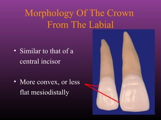 Maxillary Lateral and Mandibular Incisors | PPT