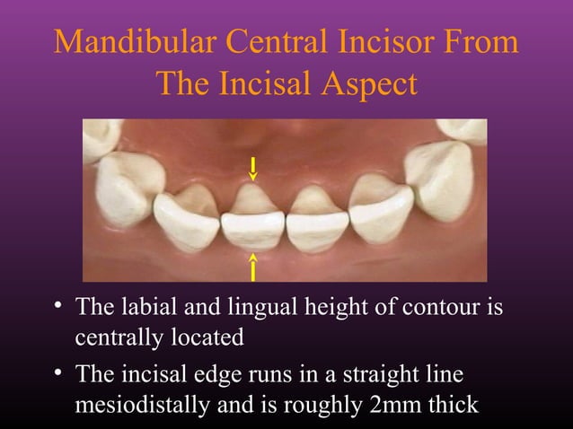Maxillary Lateral and Mandibular Incisors | PPT | Dental Health ...