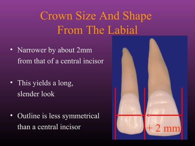 Maxillary Lateral and Mandibular Incisors | PPT | Dental Health ...