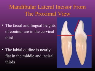 Maxillary Lateral and Mandibular Incisors | PPT
