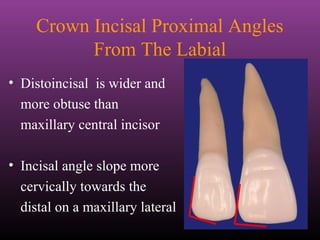 Maxillary Lateral and Mandibular Incisors | PPT