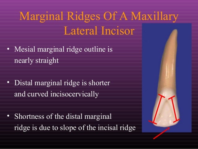 Maxillary Lateral and Mandibular Incisors