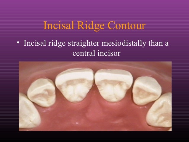 Maxillary Lateral and Mandibular Incisors