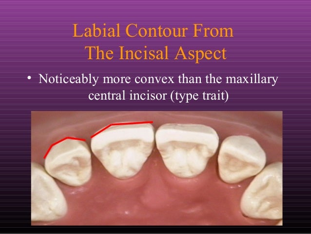 Maxillary Lateral and Mandibular Incisors