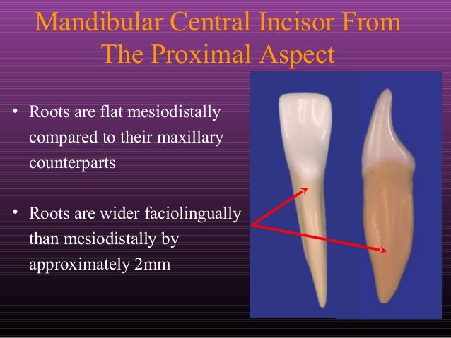 Maxillary Lateral and Mandibular Incisors
