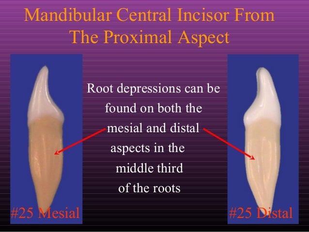 Maxillary Lateral and Mandibular Incisors