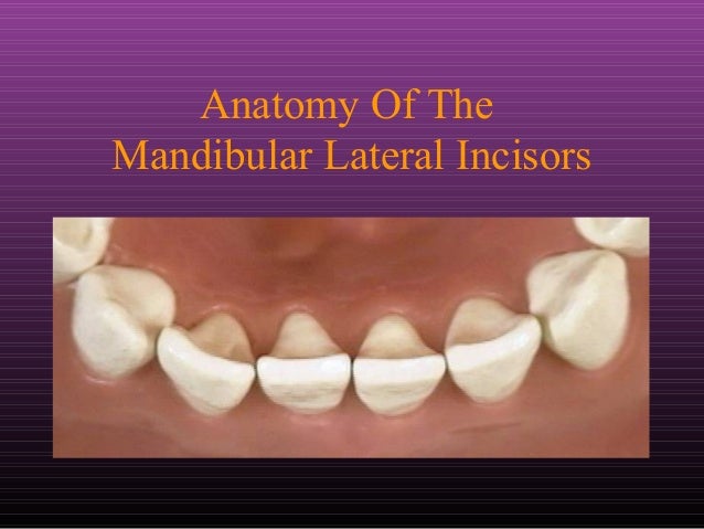 Maxillary Lateral and Mandibular Incisors