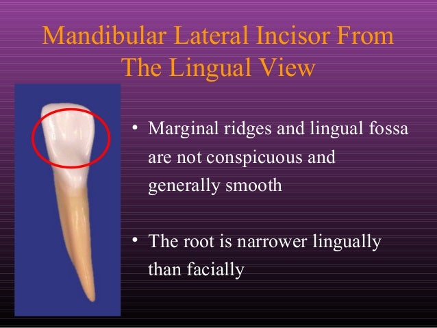 Maxillary Lateral and Mandibular Incisors