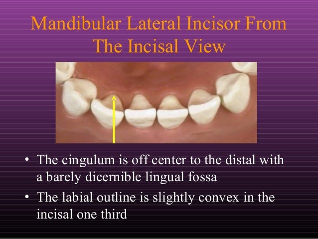 Maxillary Lateral and Mandibular Incisors