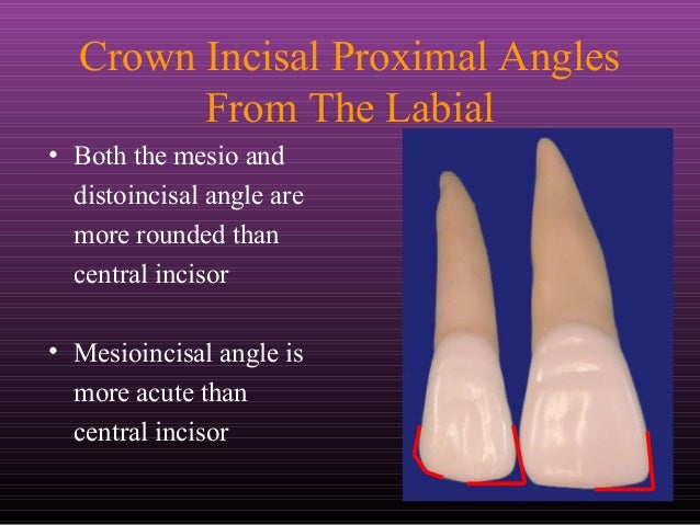 Maxillary Lateral and Mandibular Incisors