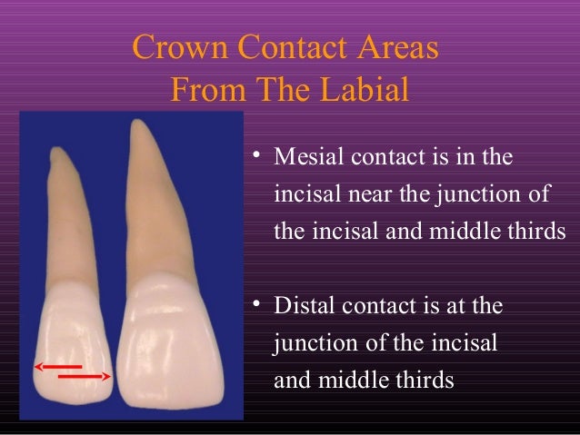 Maxillary Lateral and Mandibular Incisors