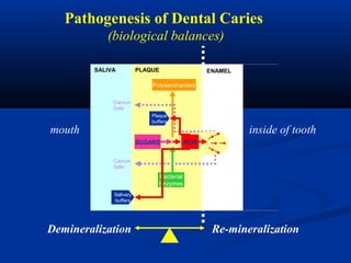 Measuring Dental Caries | PPT