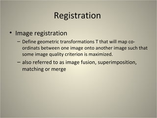 Mutual Information Algorithm applied to rigid registration | PDF
