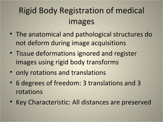 Mutual Information Algorithm applied to rigid registration | PDF