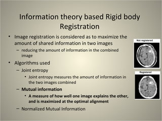 Mutual Information Algorithm applied to rigid registration | PDF