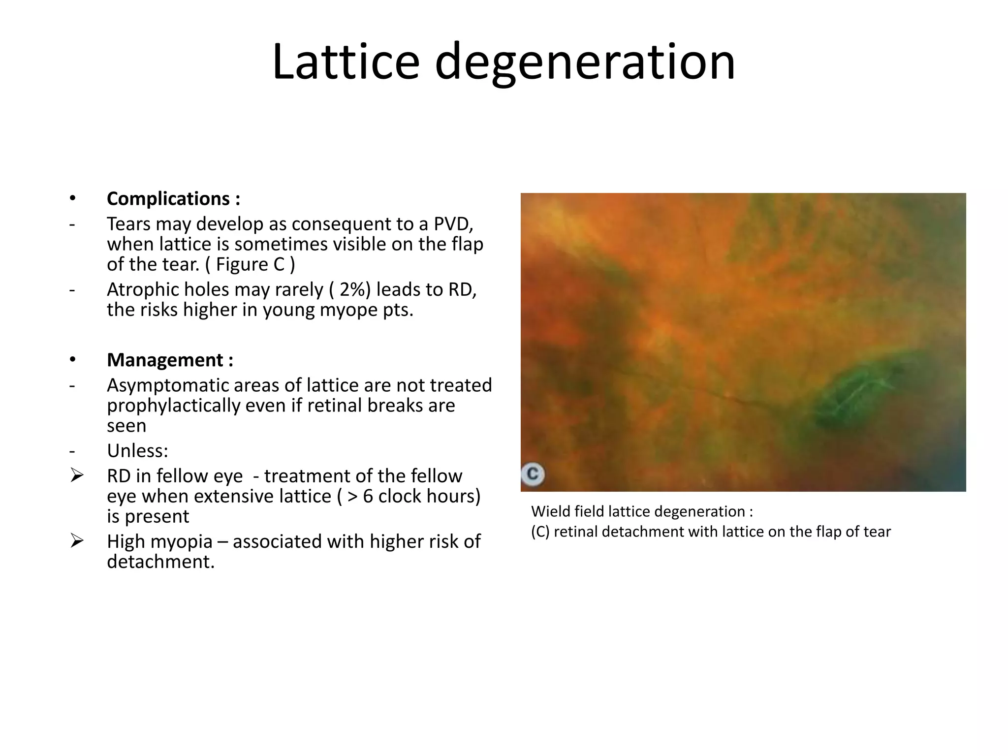 3 mirror, retinal break.pptx