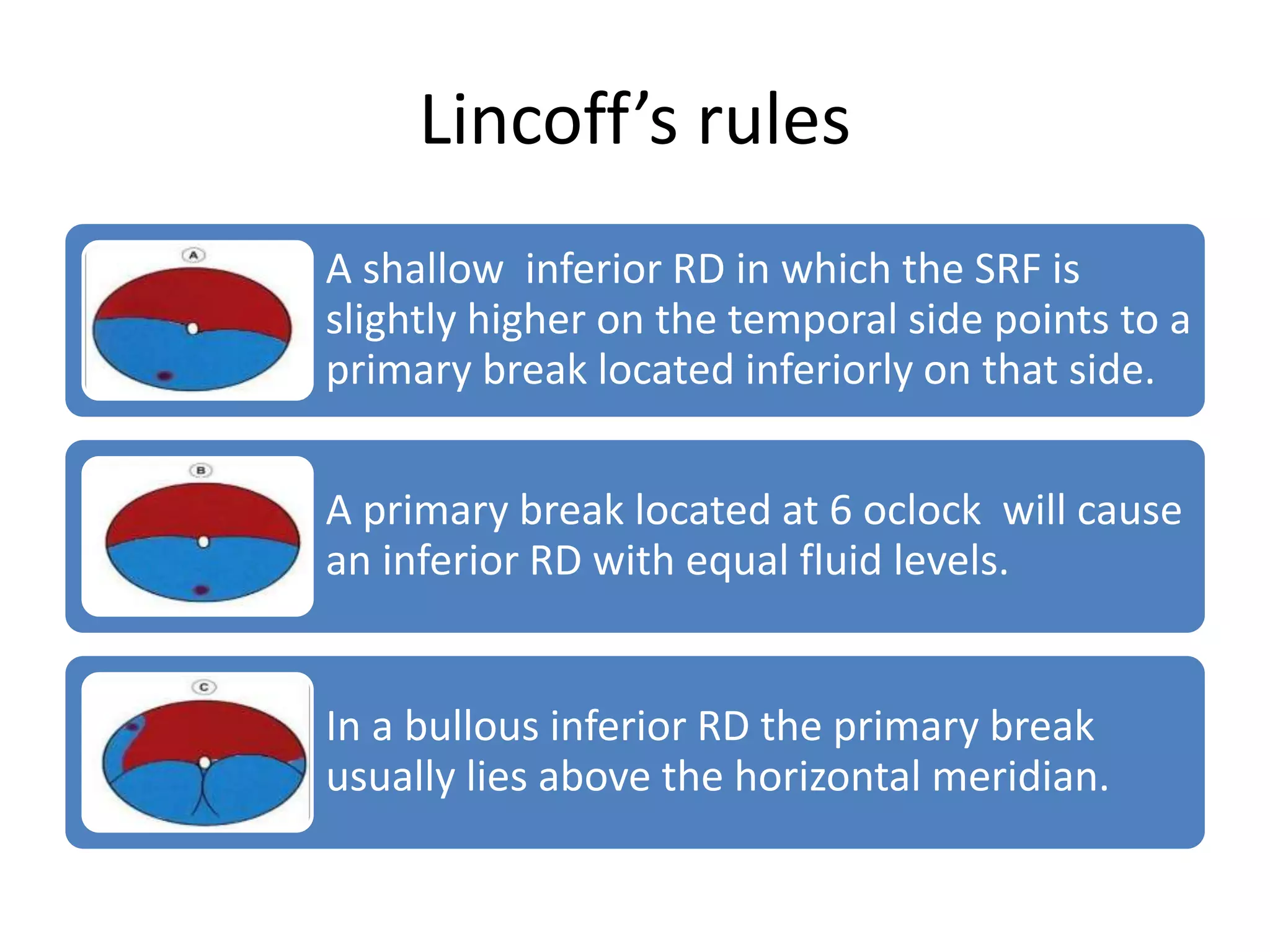 3 mirror, retinal break.pptx