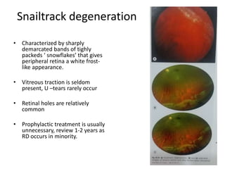 3 mirror, retinal break.pptx