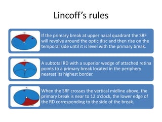 3 mirror, retinal break.pptx