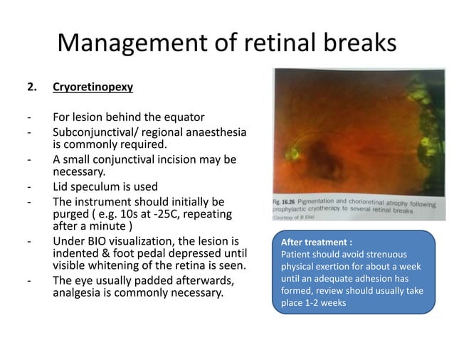 3 mirror, retinal break.pptx | Eye and Vision Conditions | Diseases and ...