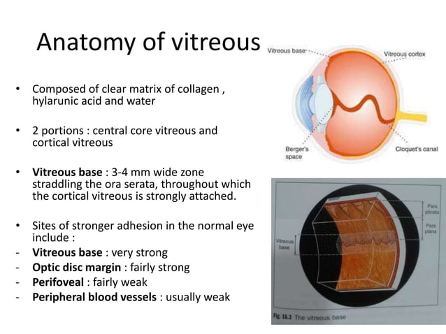 3 mirror, retinal break.pptx | Eye and Vision Conditions | Diseases and ...