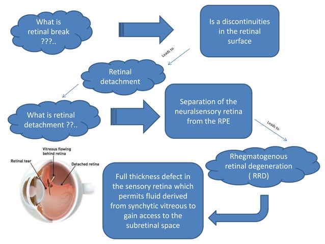 3 mirror, retinal break.pptx | Eye and Vision Conditions | Diseases and ...