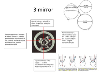 3 mirror, retinal break.pptx