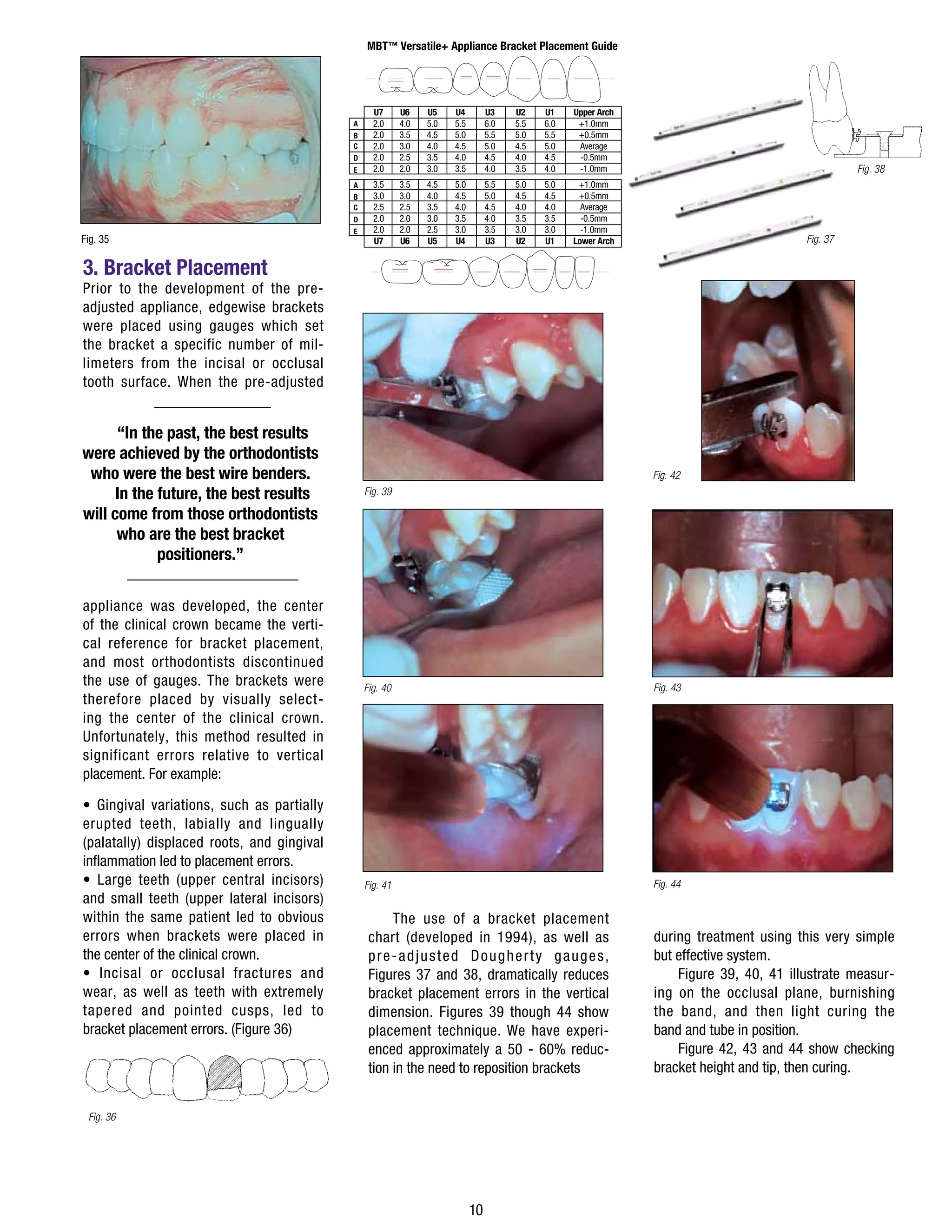 MBT TECHNIQUE - ORTHODONTIC EDUCATION FOR GENERAL PRACTITIONERS. | PDF