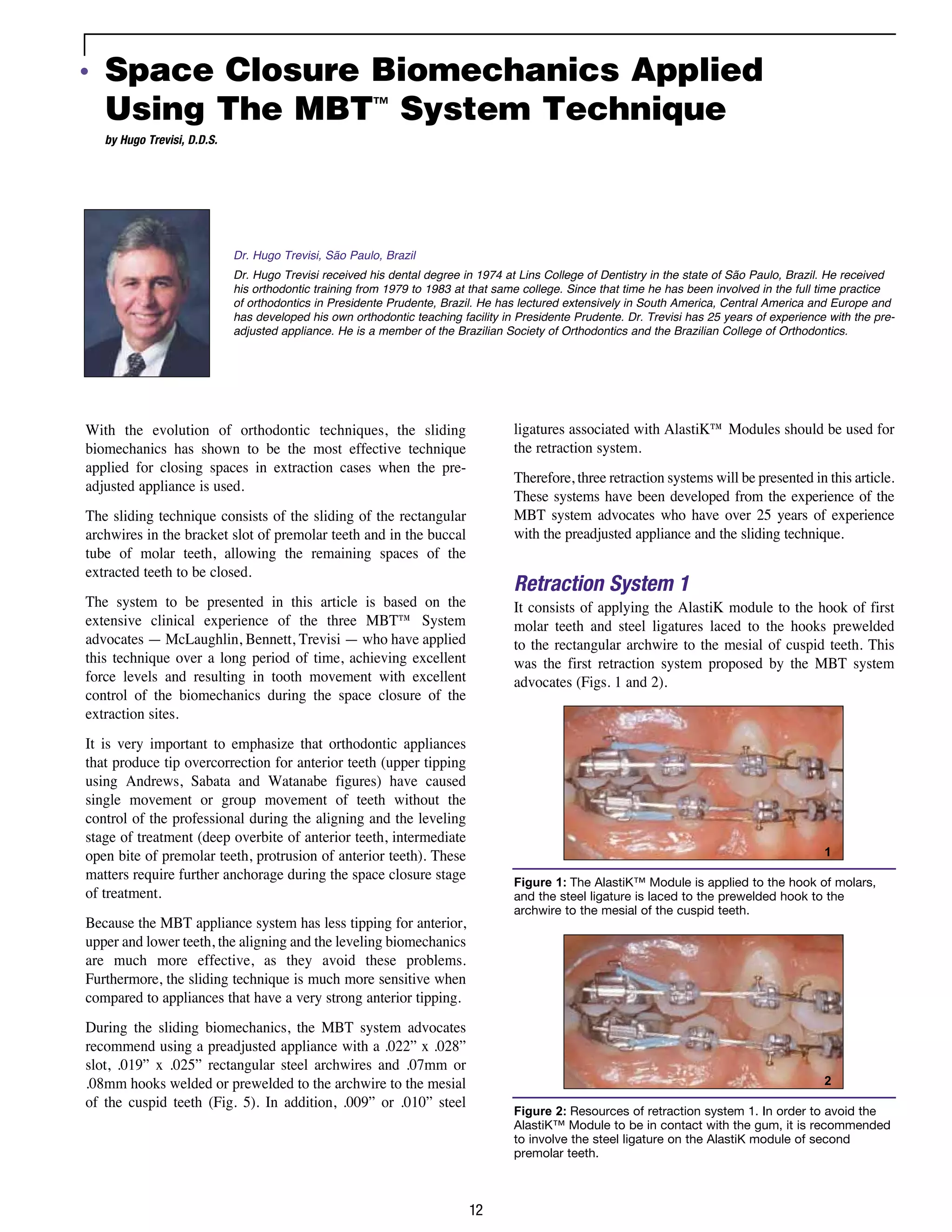 MBT TECHNIQUE - ORTHODONTIC EDUCATION FOR GENERAL PRACTITIONERS. | PDF