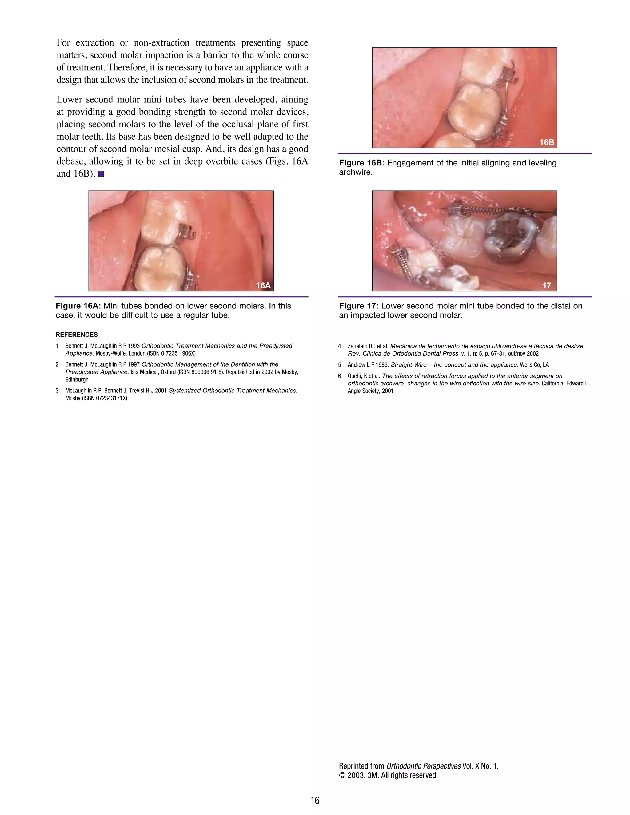 MBT TECHNIQUE - ORTHODONTIC EDUCATION FOR GENERAL PRACTITIONERS. | PDF
