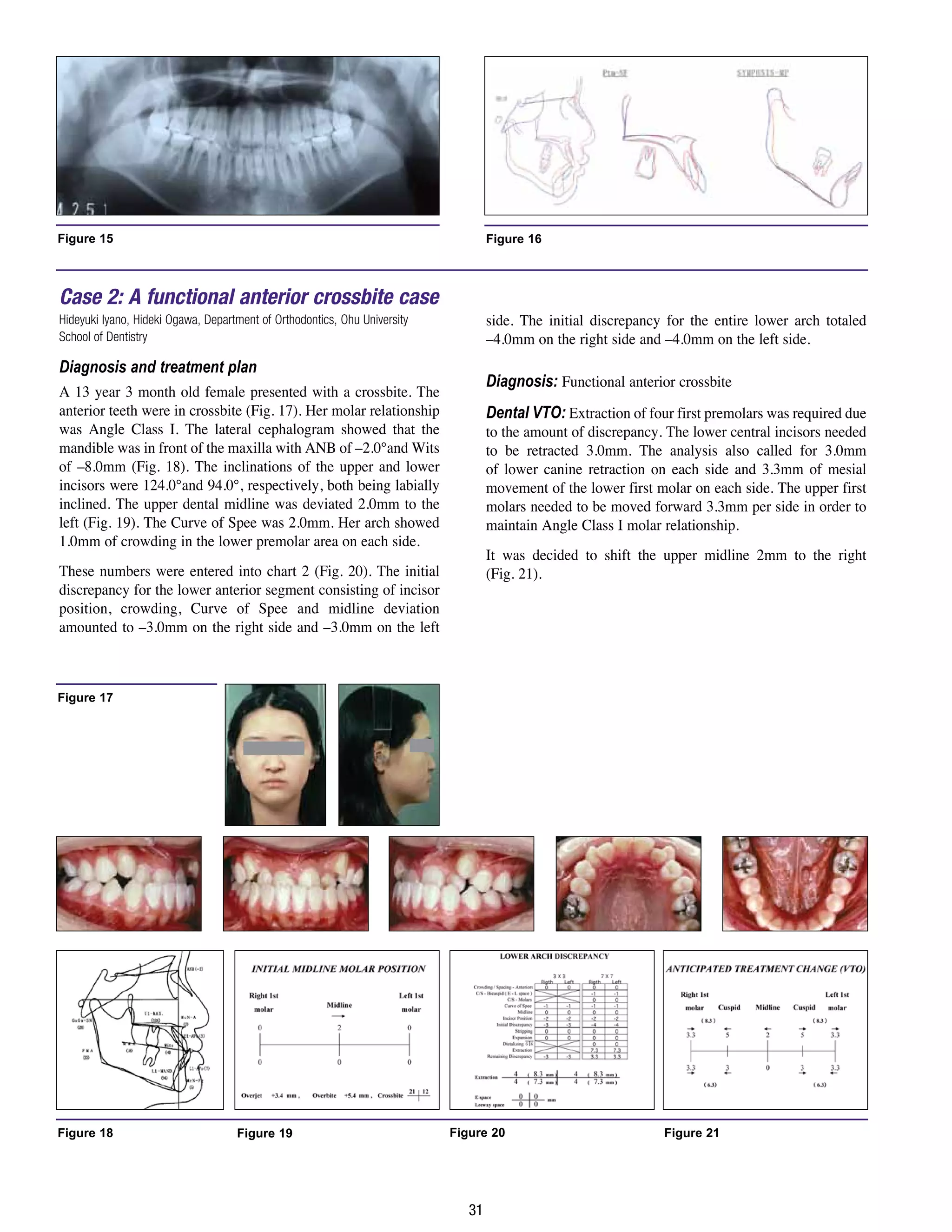 MBT TECHNIQUE - ORTHODONTIC EDUCATION FOR GENERAL PRACTITIONERS. | PDF