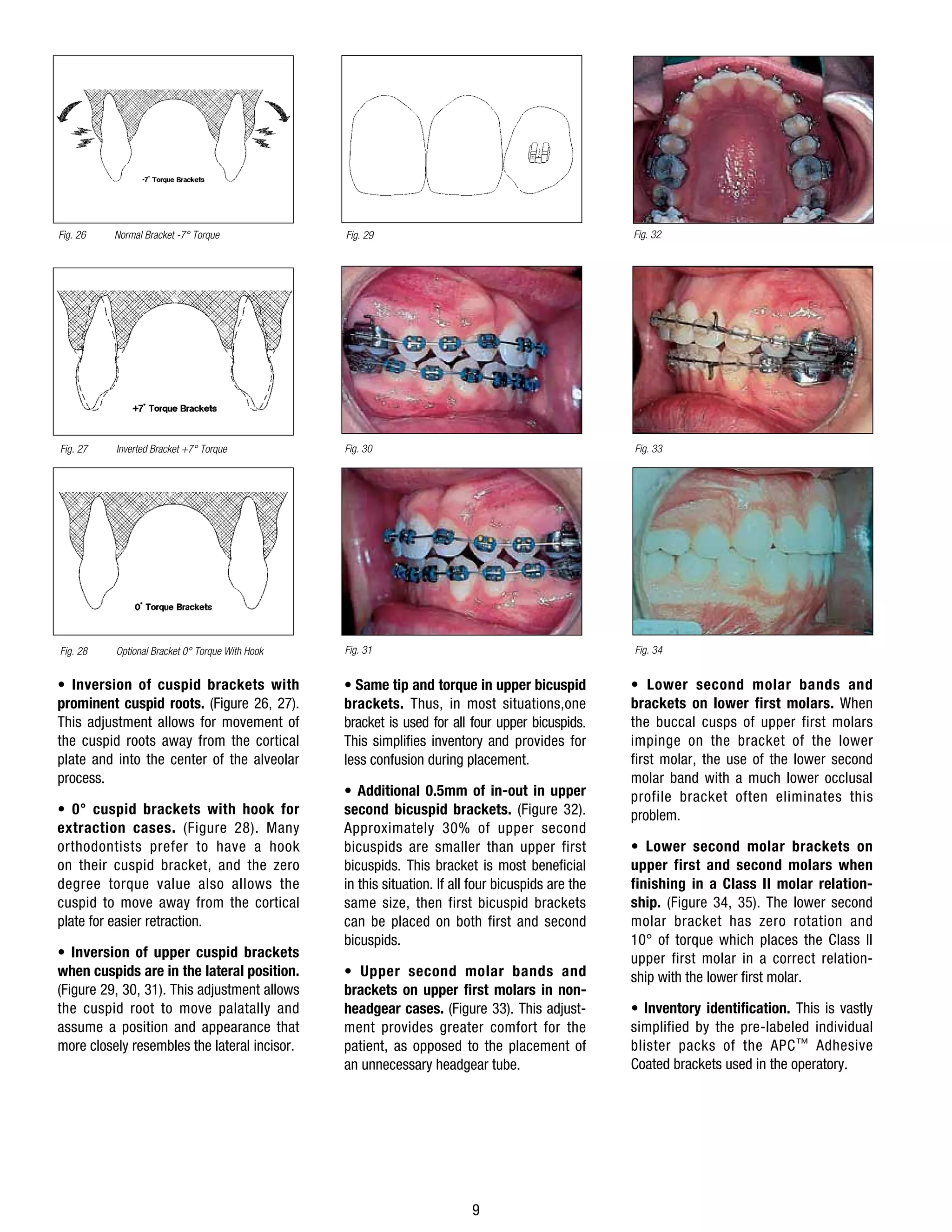 MBT TECHNIQUE - ORTHODONTIC EDUCATION FOR GENERAL PRACTITIONERS. | PDF