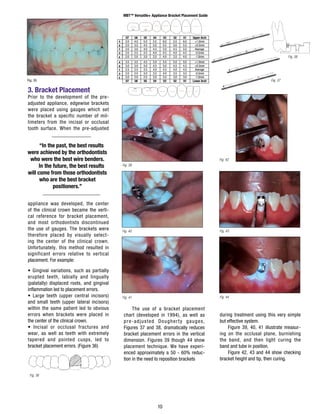 MBT TECHNIQUE - ORTHODONTIC EDUCATION FOR GENERAL PRACTITIONERS. | PDF