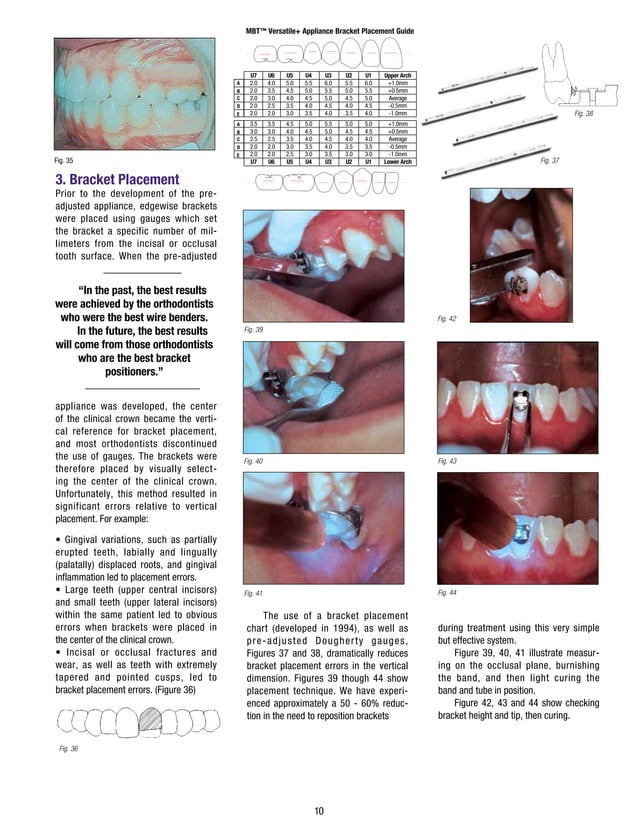 MBT TECHNIQUE - ORTHODONTIC EDUCATION FOR GENERAL PRACTITIONERS. | PDF