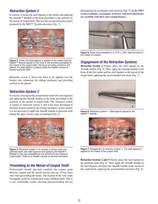 MBT TECHNIQUE - ORTHODONTIC EDUCATION FOR GENERAL PRACTITIONERS. | PDF