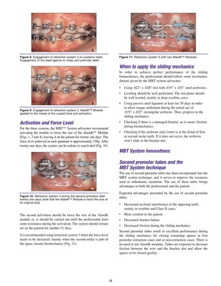 MBT TECHNIQUE - ORTHODONTIC EDUCATION FOR GENERAL PRACTITIONERS. | PDF