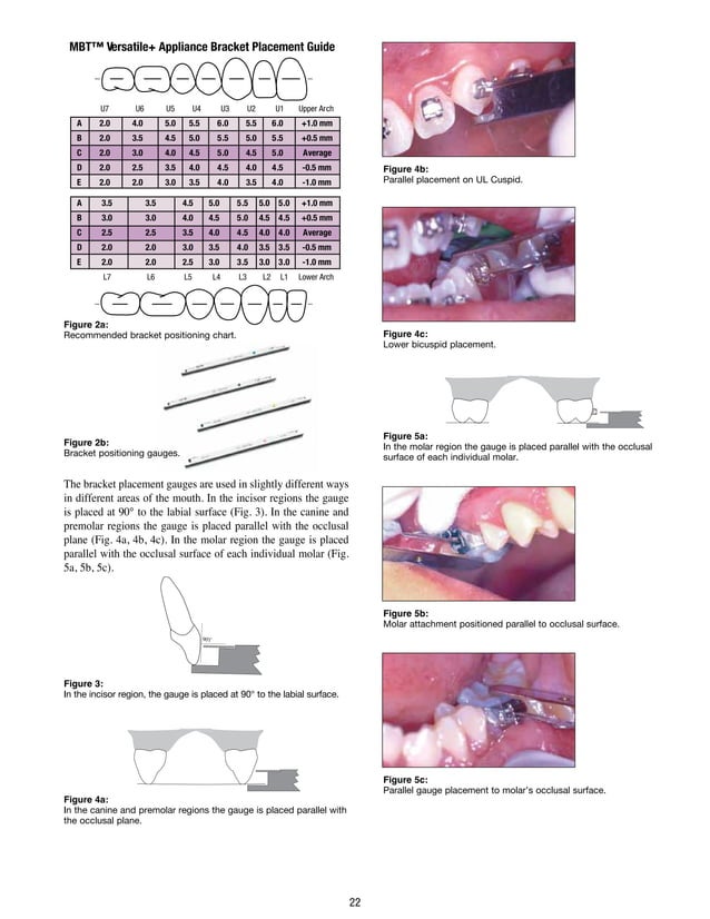 MBT TECHNIQUE - ORTHODONTIC EDUCATION FOR GENERAL PRACTITIONERS. | PDF