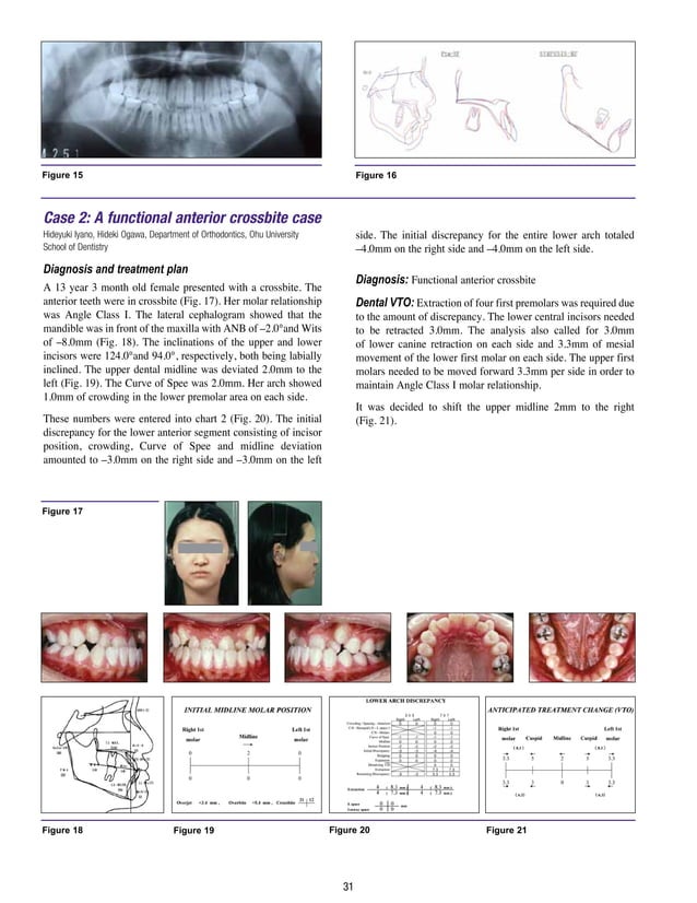 MBT TECHNIQUE - ORTHODONTIC EDUCATION FOR GENERAL PRACTITIONERS. | PDF